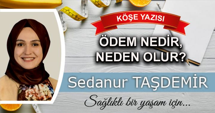 Ödem nedir, neden olur? - Sedanur Taşdemir Yazıları - Bolu Hedef
